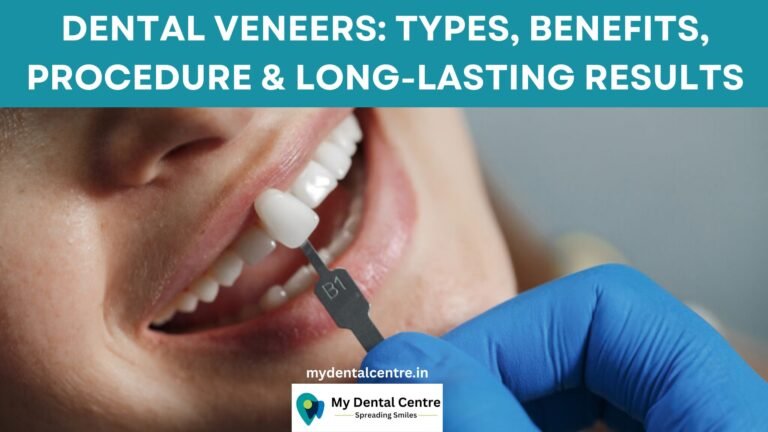 Dental Veneers: Types, Benefits, Procedure & Long-Lasting Results