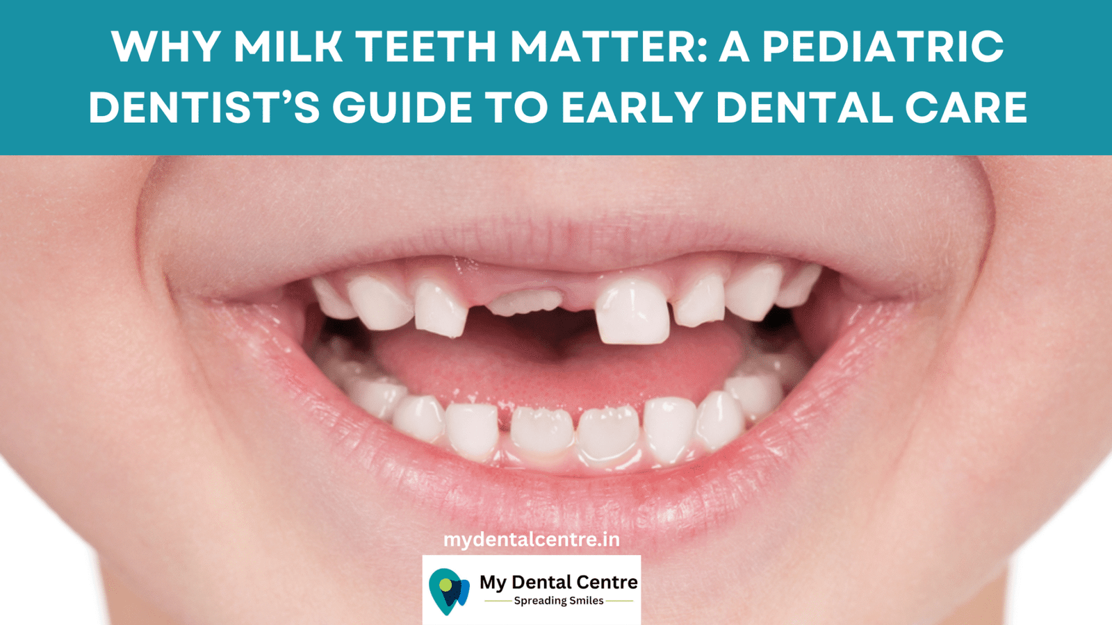 Why Milk Teeth Matter: A Pediatric Dentist’s Guide to Early Dental Care